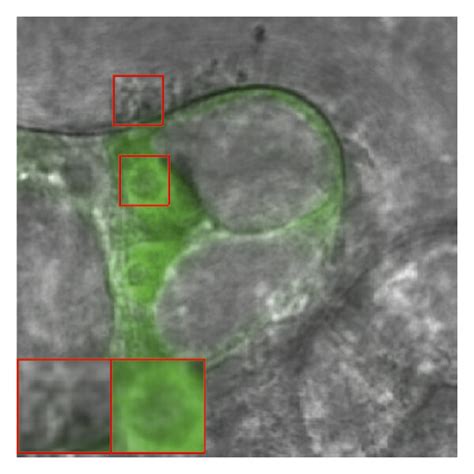 The Second Set Of Gfp And Phase Contrast Image Fusion Results A Gfp Download Scientific