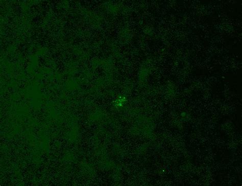 Python Opencv Remove Background Noise And Increase Signal Strength Stack Overflow