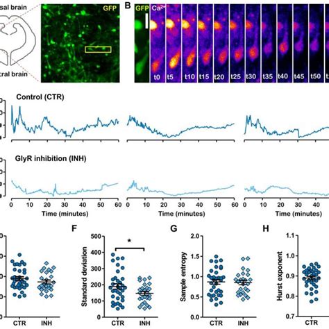 Calcium Imaging And Analysis Of Calcium Oscillations In Cortical