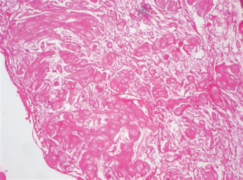 A A Large Number Of Nests And Islands Of Ghost Cells In The