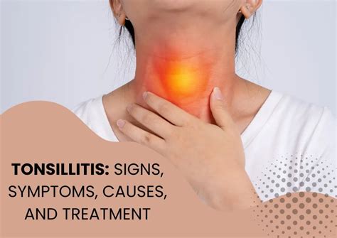 What Is Tonsillitis Signs Symptoms Clinical Features