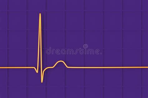 Electrocardiogram Ecg Displaying A Junctional Rhythm 3d Illustration