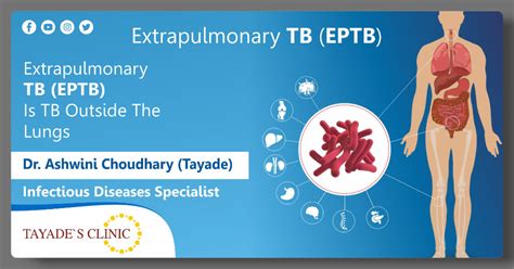 Extrapulmonary Tuberculosis Symptoms