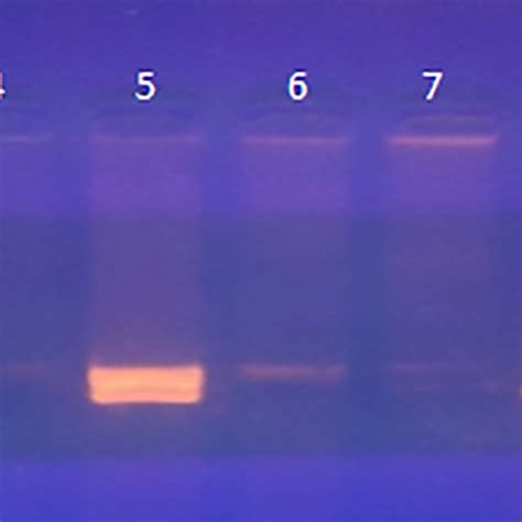 Detection Of Mutations Associated With Clarithromycin Resistance In Download Scientific Diagram