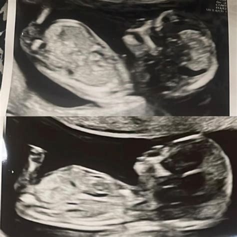 Gender Prediction Mumsnet