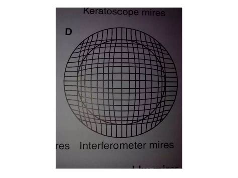 Corneal Topography Wavefront Analysis Pptx