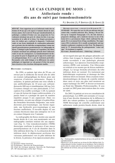 Pdf Rounded Atelectasis A Follow Up Of 10 Years By Ct