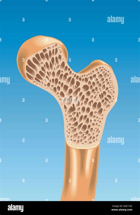 Bone Mass Loss Stock Vector Images Alamy