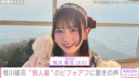 【写真・画像】“握手会ヲタク約1名”ske48・相川暖花（22）、“別人級”ビフォーアフターに驚きの声「同一人物？ai？」「無加工で載せる心