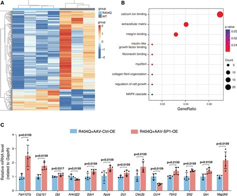Deficiency Of Transcription Factor Sp1 Contributes To Hypertrophic