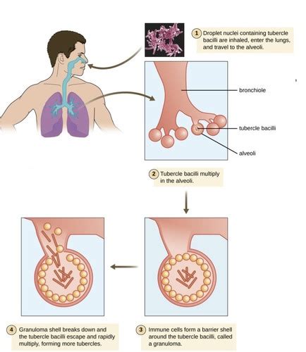 Microbiology Causative Agents Flashcards Quizlet