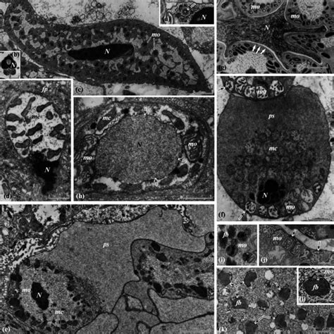 Details Of The Structure Of The Nematode Sperm A Centrioles From Ten Download Scientific