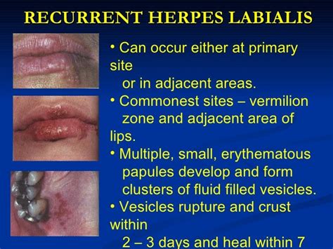 Bacterial Viral And Mycotic Infections