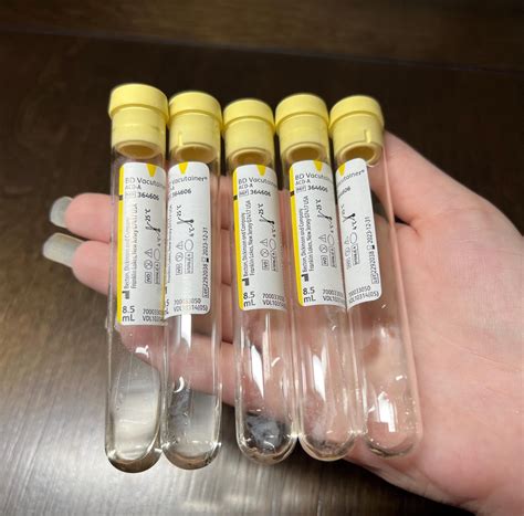5 Bd Acd A Vacutainer Tubes Prp Tubes Acid Citrate Dextrose And