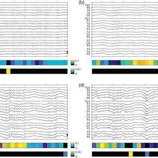 Visual Explanation For EEG Epochs Correctly Classified By The Global Download Scientific