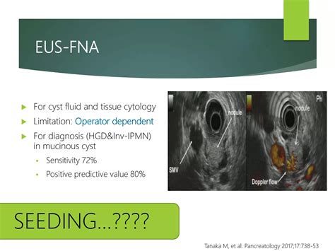 Management Of Ipmn Pptx