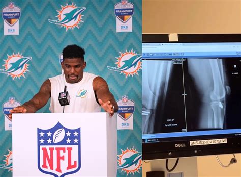 Onlyfans Model Sophie Hall S Lawsuit Against Tyreek Hill Takes A Twist As She Admits They Had