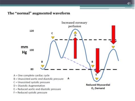 Iabp Instrumentation Indications And Complications