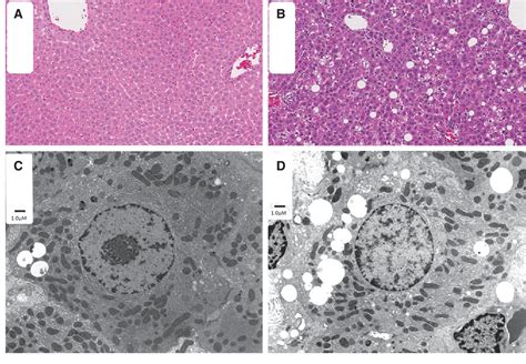 Figure 1 From Nonclinical Safety Profile Of Revusiran A 1st Generation