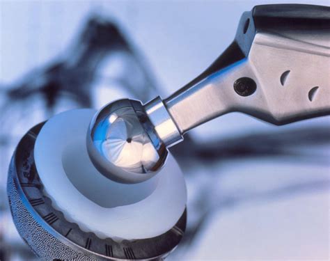 Materials Used In Hip Replacement Surgery At Randall Maupin Blog
