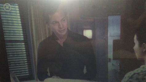 Anencephalic Pre Birth Private Practice Youtube