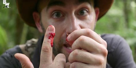 Coyote Peterson Gets Repeatedly Bitten By Leafcutter Ant