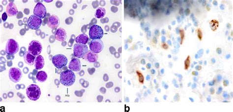 Showing Aggregates Of Mast Cells Containing Mixed Black And Orange