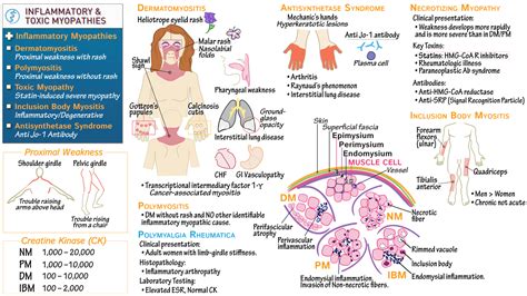Clinical Pathology Dermatomyositis And Polymyositis Ditki Medical And Biological Sciences