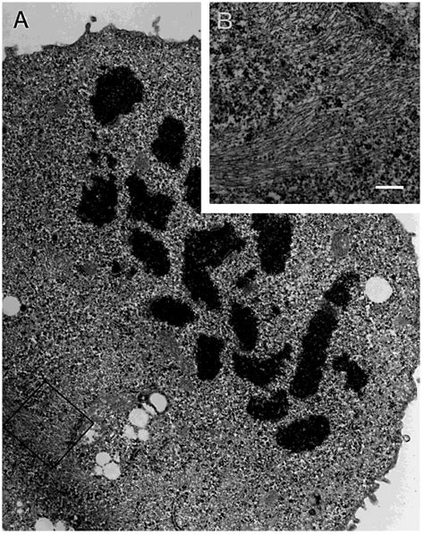 Electron Micrograph Of A Thin Section Of A Mitotic Cell Transfected