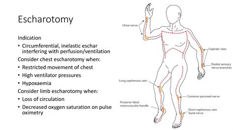 Surgical Management Of Burn Injuries Pptx