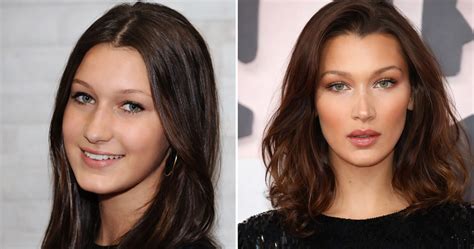 Bella Hadid Before Plastic Surgery Eternity Life Tourism