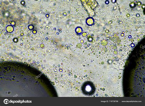 Yeşil Mukus Mikroskop Altında Öksürme Grip Hücrelerine Avustralya Da Hasta — Stok Foto © Wedge