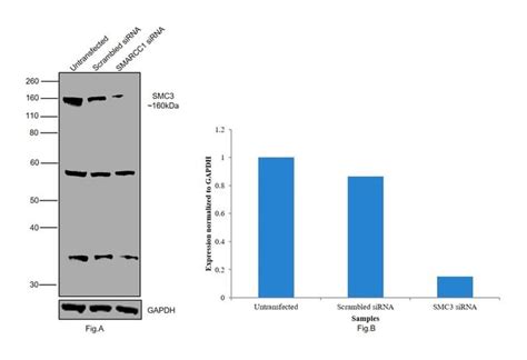 Invitrogen Smc3 Polyclonal Antibody 100 μl Unconjugated Antibodies