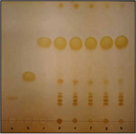 A Separation Of Neutral Lipids Fractions Extracted By The Five