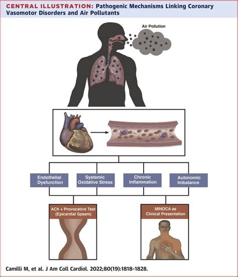 Air Pollution And Coronary Vasomotor Disorders In Patients With
