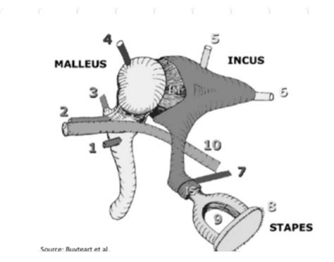 Ossicles Anatomy Quiz