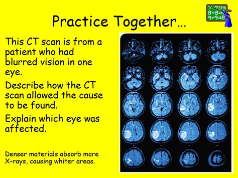 Edexcel Sb2 Brain And Spinal Cord Problems Complete Lesson Gcse Biology Teaching Resources