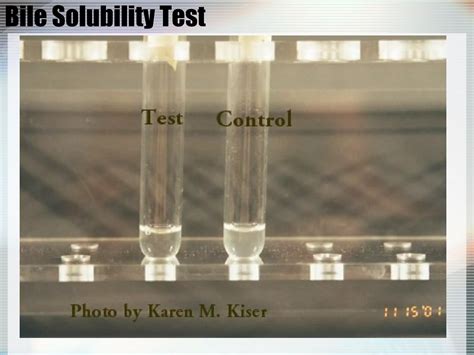 Biochemical Tests For Gram Positive Cocci Ppt