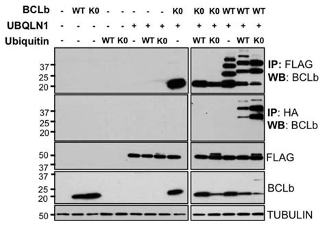 The Sti And Uba Domains Of Ubqln1 Are Critical Determinants Of