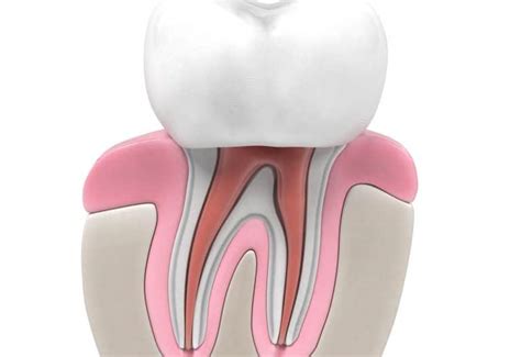 How Can You Tell If Your Tooth Needs Root Canal Treatment Leawood Ks
