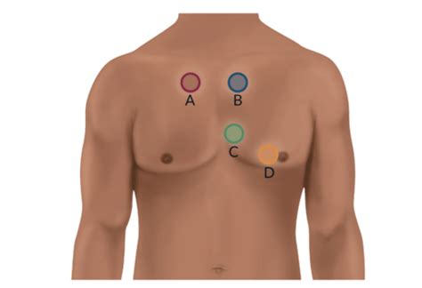 Heart Sounds And Concentric Eccentric Hypertrophy Flashcards Quizlet