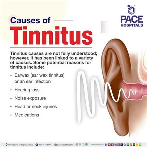 Tinnitus Pulsatile