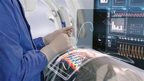 Prostate Artery Embolization Pae Philips Prostate Artery Embolization Pae Philips