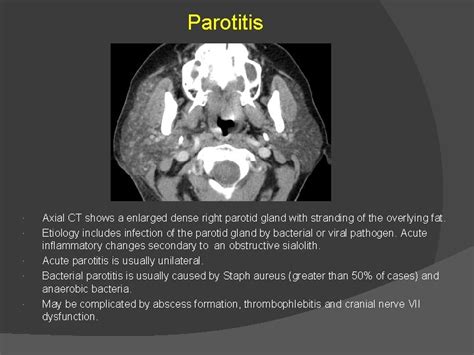 Pediatric Facial Swelling A Guide To Radiologic Diagnosis