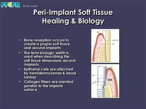 Stage I And Ii Surgery