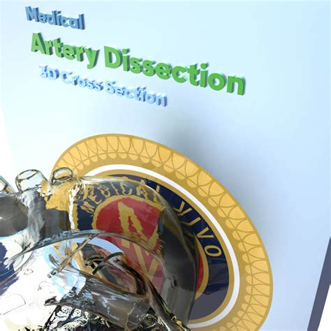 Mv Artery Dissection Medical Cardiovascular 3d Cross Section 2d 3d Resources