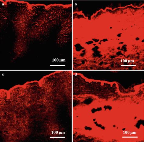 Confocal Microscopy For Visualization Of Skin Penetration Plastic