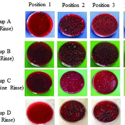 A Schematic Representation Of Microbial Colonies In All Four Positions
