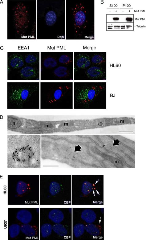 mutant pml forms pml cb a mutant pml mut pml forms cytoplasmic