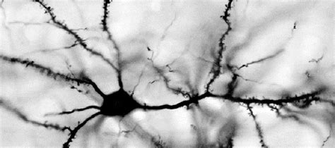 Funding Boost For Autism Research Biomedical Sciences